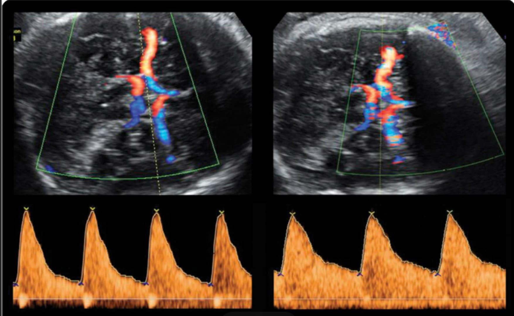 Eco Doppler da Gravidez - Clínica Particular de Viseu